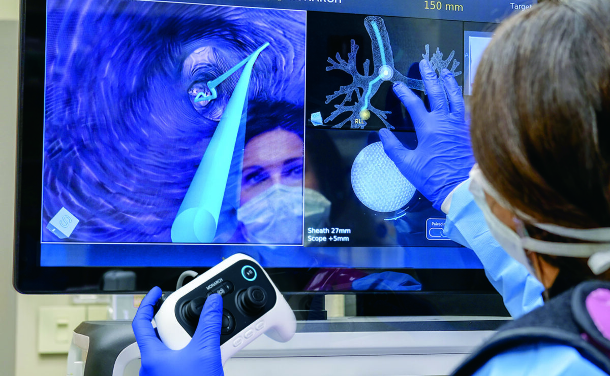 Memorial Interventional Pulmonology Team Leads the State - Memorial ...