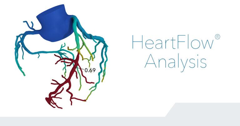 Memorial Health System Adopts HeartFlow Analysis, a New Diagnostic Tool ...
