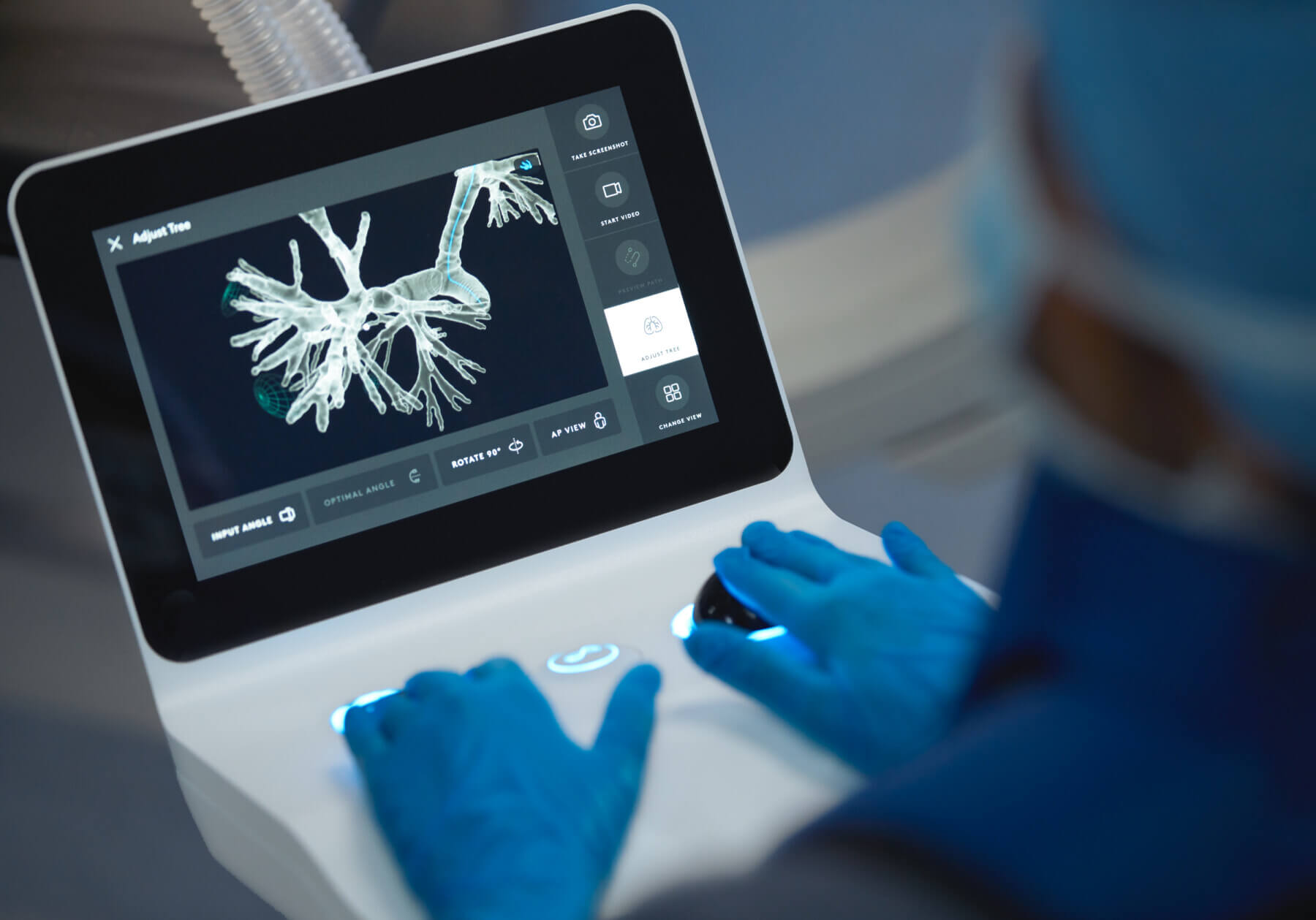 Lung Cancer Screenings - What You Need to Know - Memorial Health System